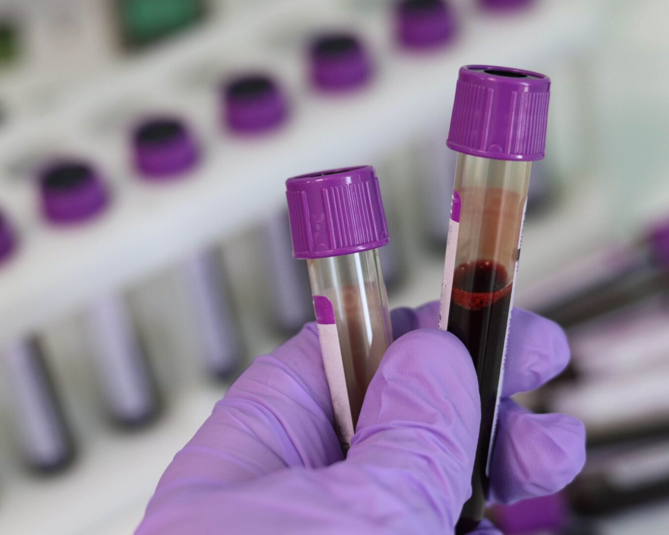 Onde fazer teste de HIV e quanto custa? | Genera