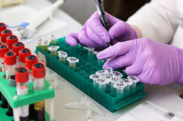 Onde fazer teste de HIV e quanto custa? | Genera